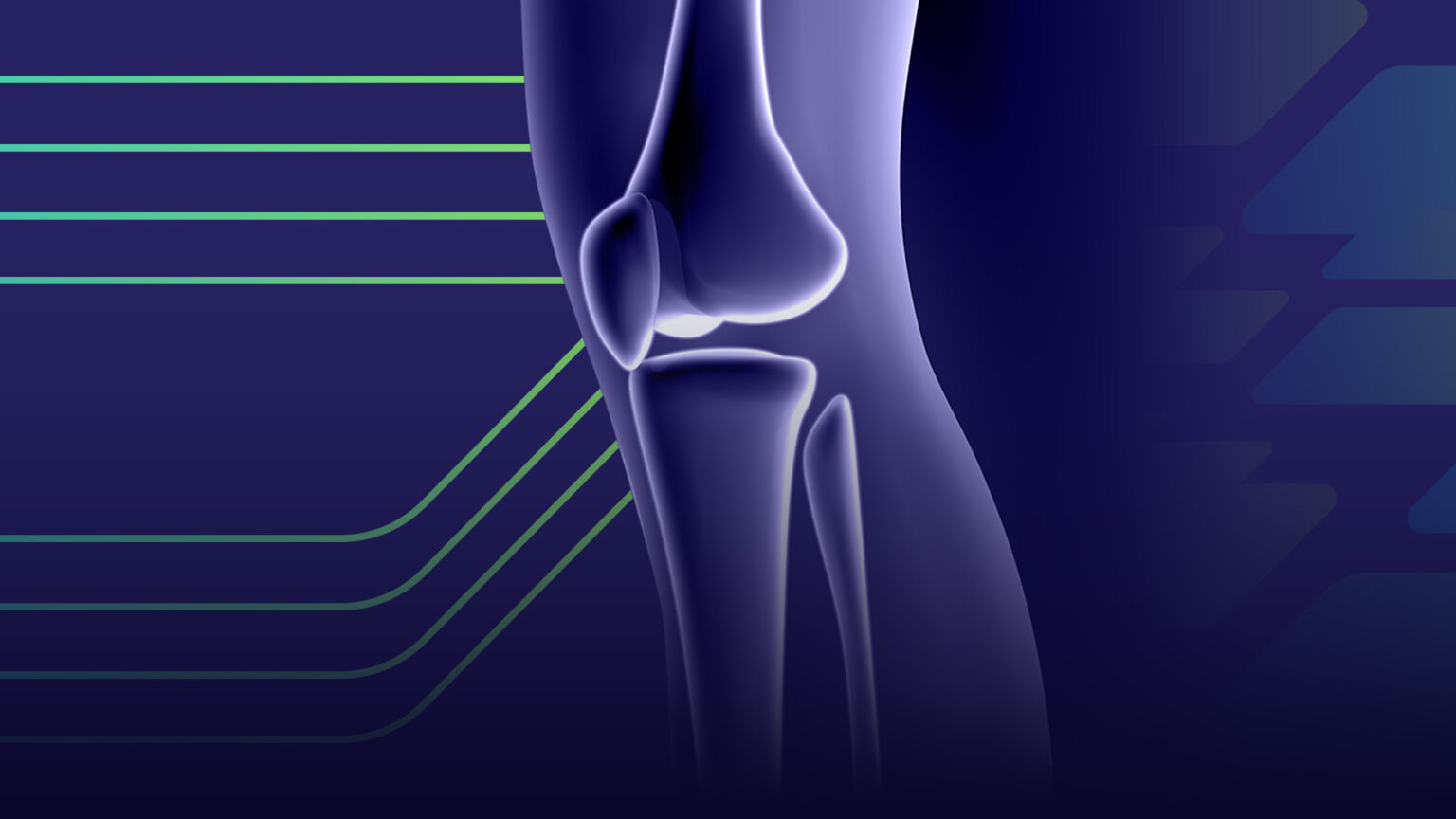 Tendinopatias do Tendão Tibial Posterior - E-fisio