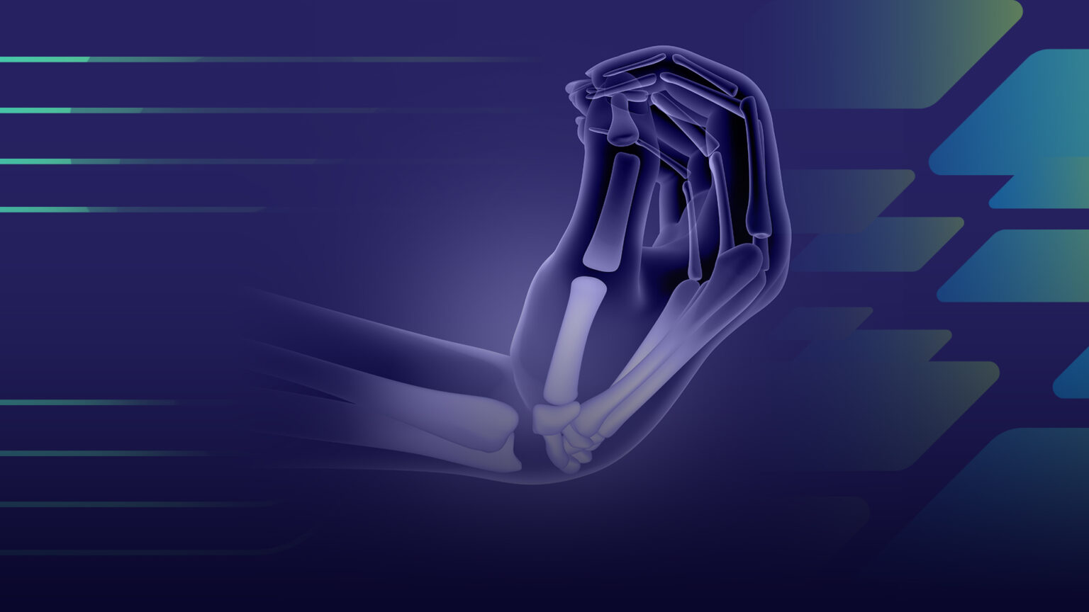 Fraturas de Platô Tibial - E-fisio