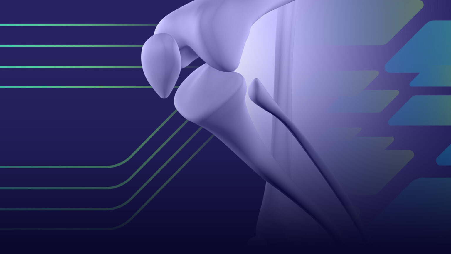 Tendinopatia calcânea - E-fisio